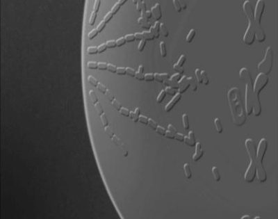 Electric Field Therapy - Immunotherapy cancer and chronic disease